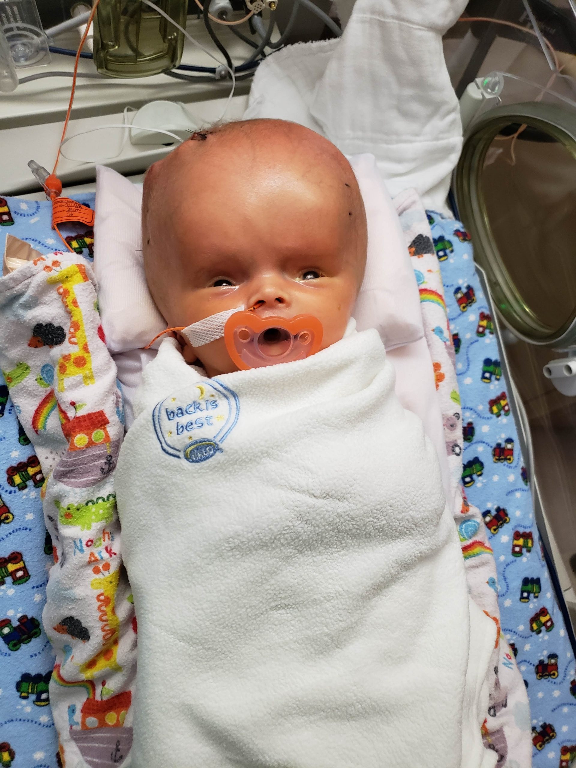 Carter’s journey with hydrocephalus